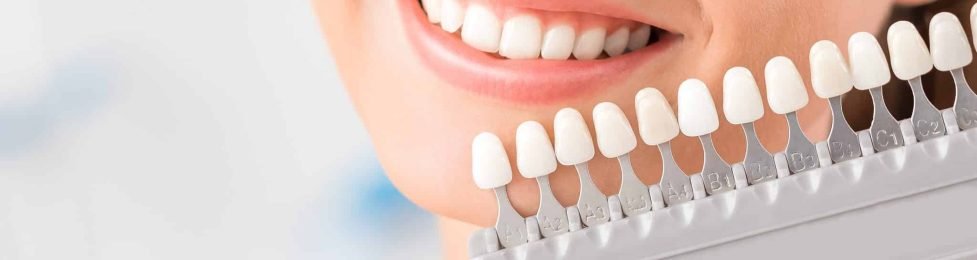 Tand bleken – Dental BeNeLux